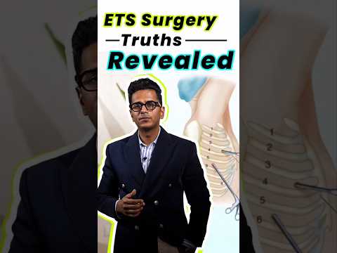 ETS Surgery truths Revealed || Compensatory Hyperhidrosis #shorts #ETSsurgery