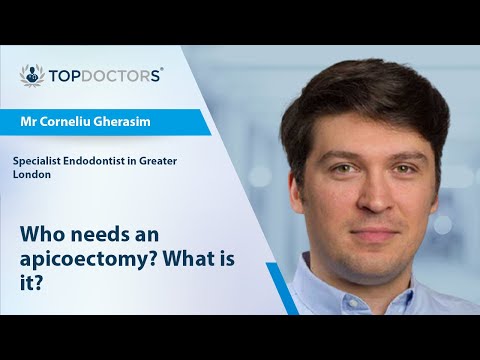 Who needs an apicoectomy? What is it? - Online interview