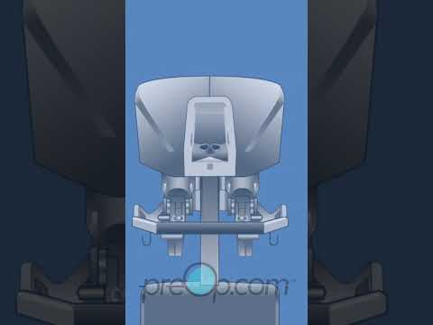 Robotic Assisted Laparoscopic Radical Prostatectomy #preop #medicine #medical #healthcare