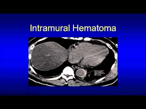 When Do I Need a non-contrast CT?