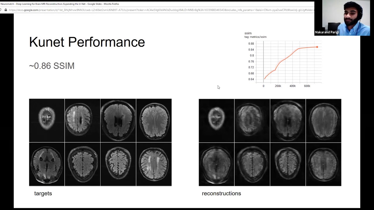 Talk: Deep Learning for Brain MRI Reconstruction: Expanding the U-Net