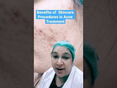 ✳️Acne Treatment Procedures | Skincare for Acne #shorts