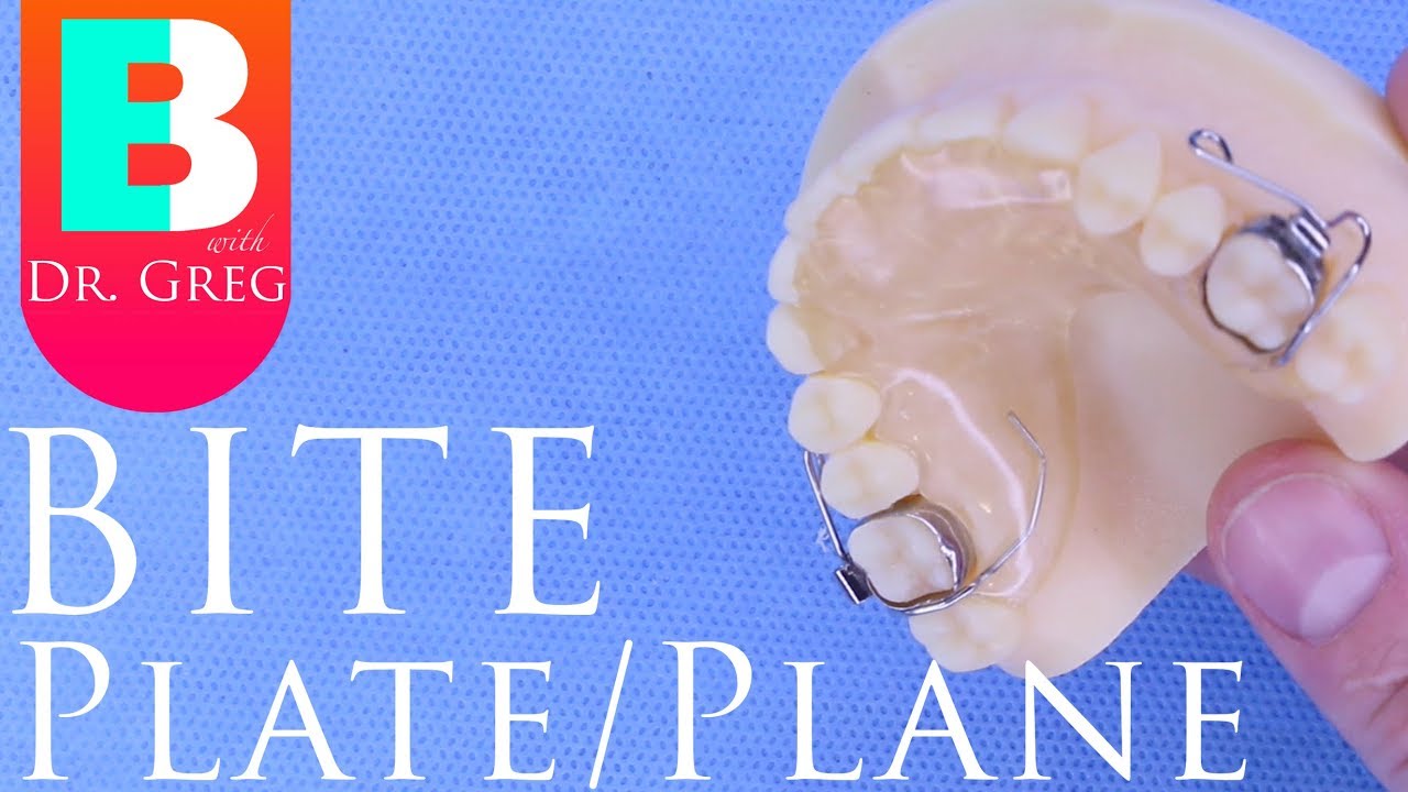 Bite Plate / Bite Plane for Braces