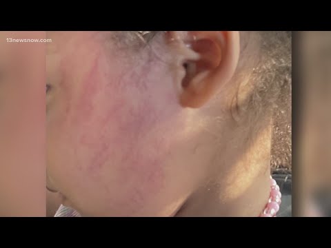 Owner of Isle of Wight daycare faces charges after 3 -year-old girl in her care is assaulted