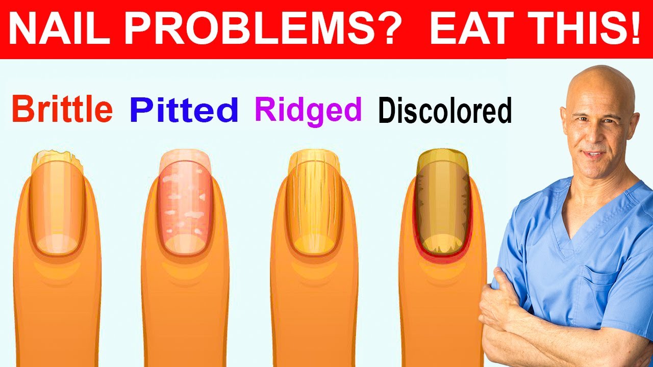 NAIL PROBLEMS ?  EAT THIS !    Dr. Mandell