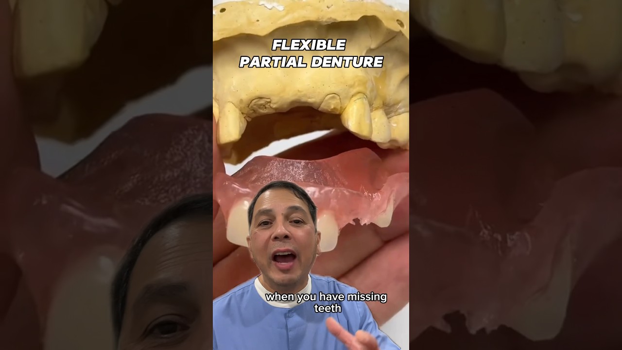 Replacing Missing Front Teeth With Flexible Partial Denture | View Mobile Dental #shorts