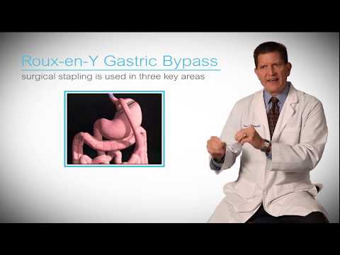 Bariatrics | Roux-en-Y Gastric Bypass for Weight Loss | Ascension Borgess | Michigan