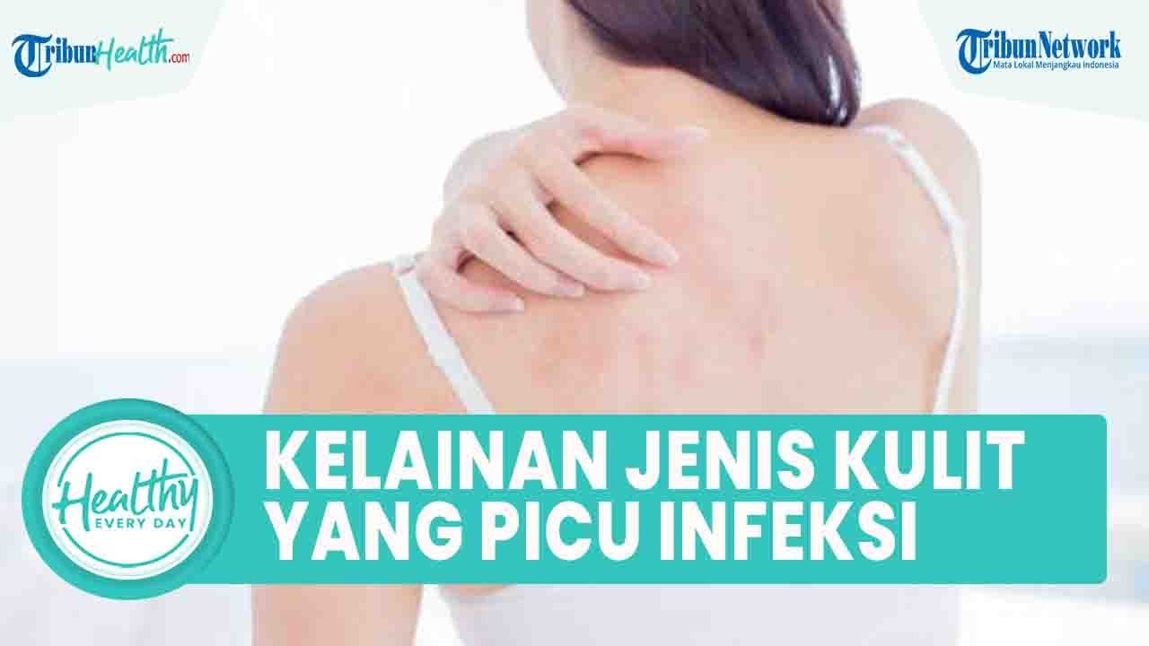 Kenali Kelainan Jenis Kulit yang Dapat Picu Rasa Gatal hingga Alergi ...