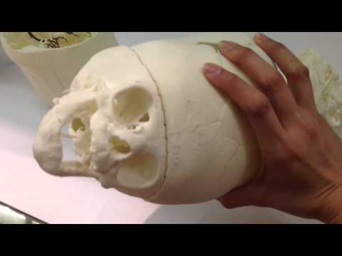 3D Printshow NYC: Medical Applications