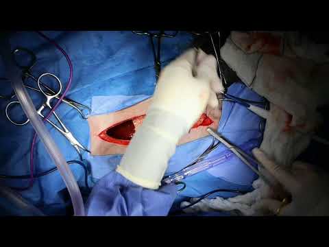 splenectomy in a dog using ligasure