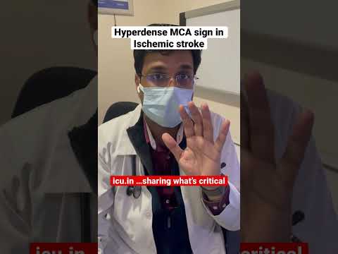 #icushort 93: Hyperdense MCA sign in Ischemic stroke #esbicm
