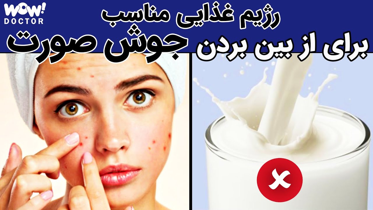 از بین بردن جوش صورت و آکنه با رژیم غذایی مناسب ؟ جوش صورت و آکنه خود