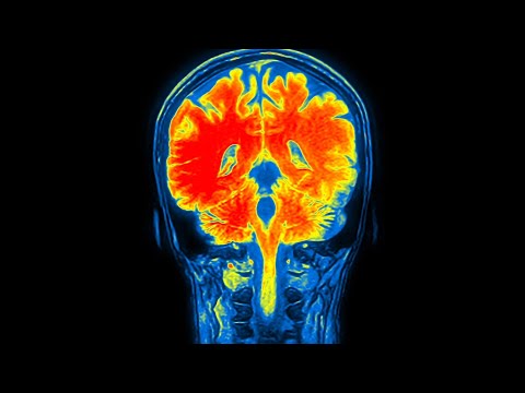 Powerful Brain Imaging Tool