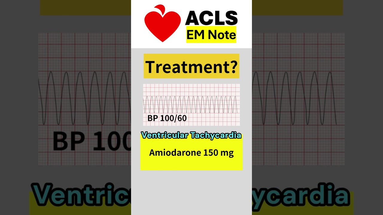 ACLS Rhyrhm Test #acls