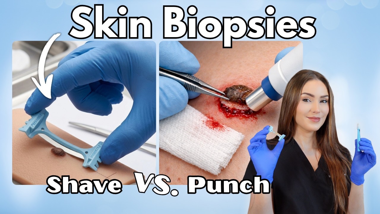 Skin Biopsies Explained + Demo | Shave vs. Punch Biopsies