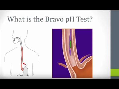 Your Bravo pH Test Experience