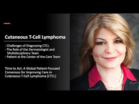 CTCL: The Role of Dermatologists in Diagnosing and Caring for Patients (Full Interview)