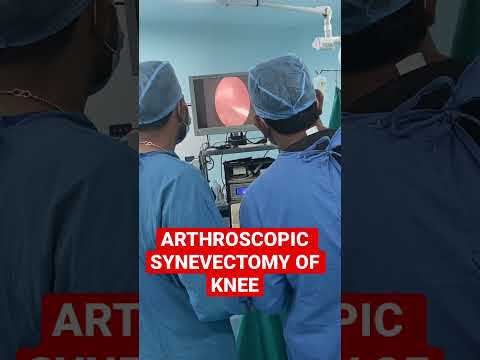 Arthroscopic synovectomy surgery of knee for Synovitis of knee in Jaipur