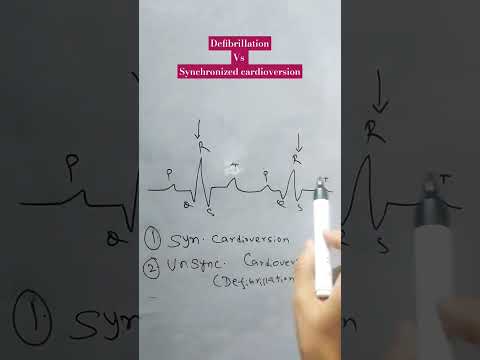 defibrillation vs synchronized cardioversion #defibrillation#cardioversion