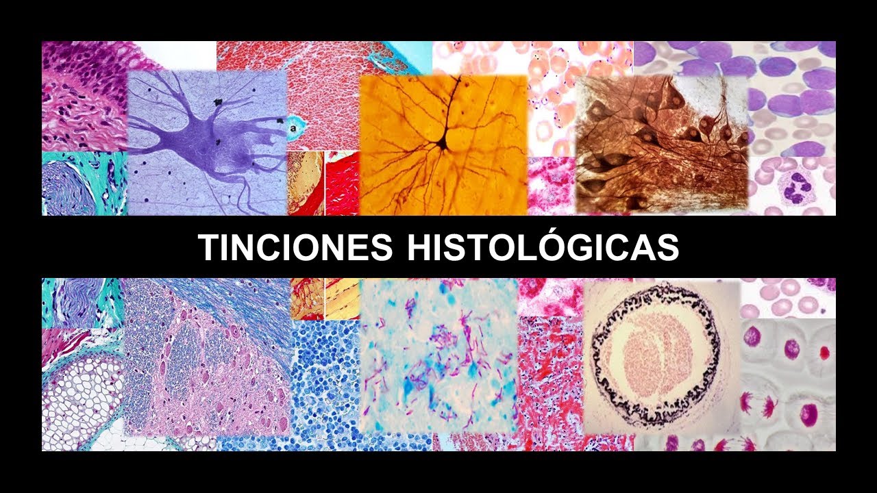 MAIN HISTOLOGICAL STAINS