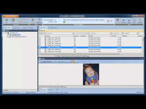 What Similarities And Differences Between Sleep, Amnesia And Coma. Part ...