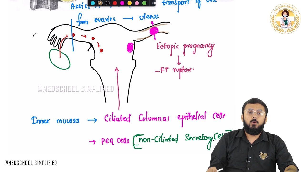 77. Anatomy of Fallopian Tube | NEET PG/FMGE/USMLE