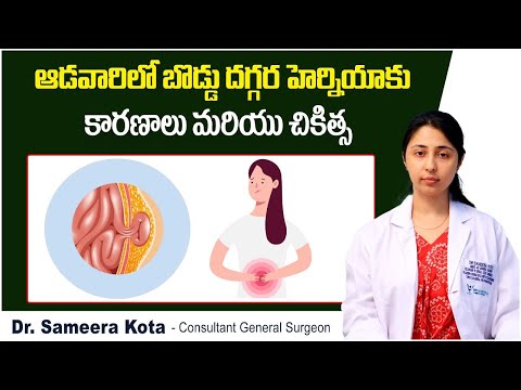 ఆడవారిలో హెర్నియా | Symptoms of Ventral Hernia in Women | Hernia Treatment in Telugu | V9 Hospitals