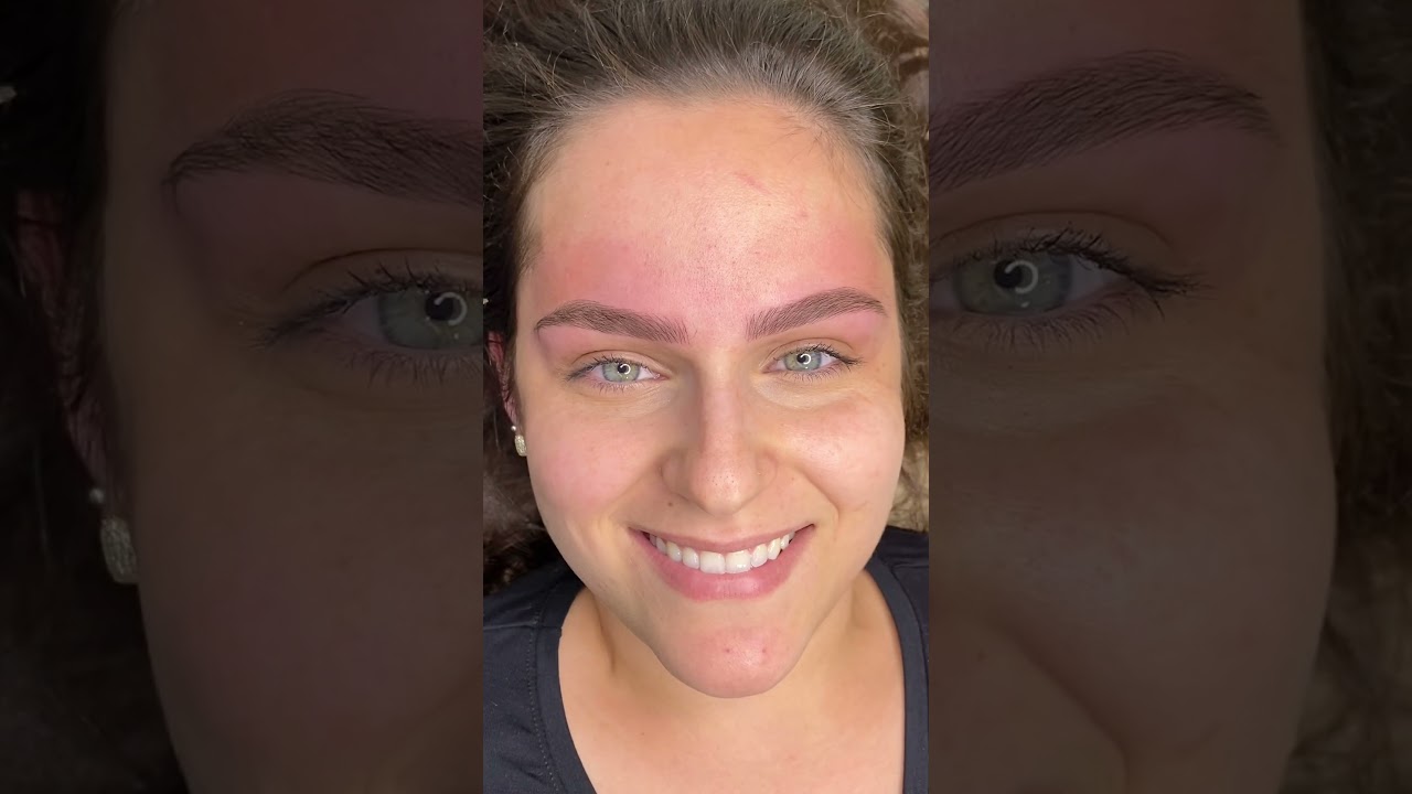 PASSO A PASSO DA TÉCNICA DE NANOFIOS NO DERMÓGRAFO! #sorts