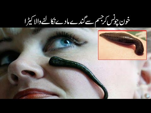 Leech Therapy for Skin Problems in urdu/hindi - Animals Valley