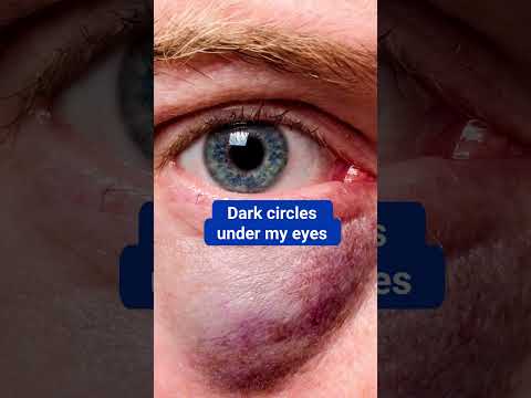 From Huge Eyebags to No Eyebags | Particle Face Cream For Men
