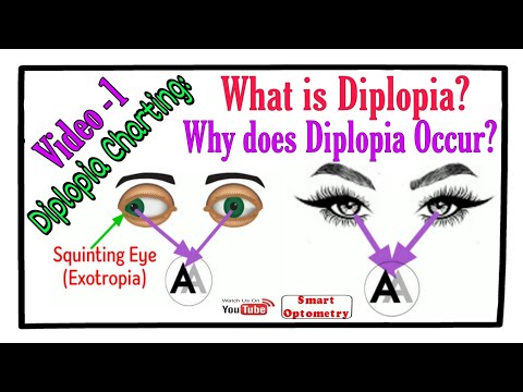 What is Diplopia & Why does Diplopia occur? (Diplopia Charting: Video-1)