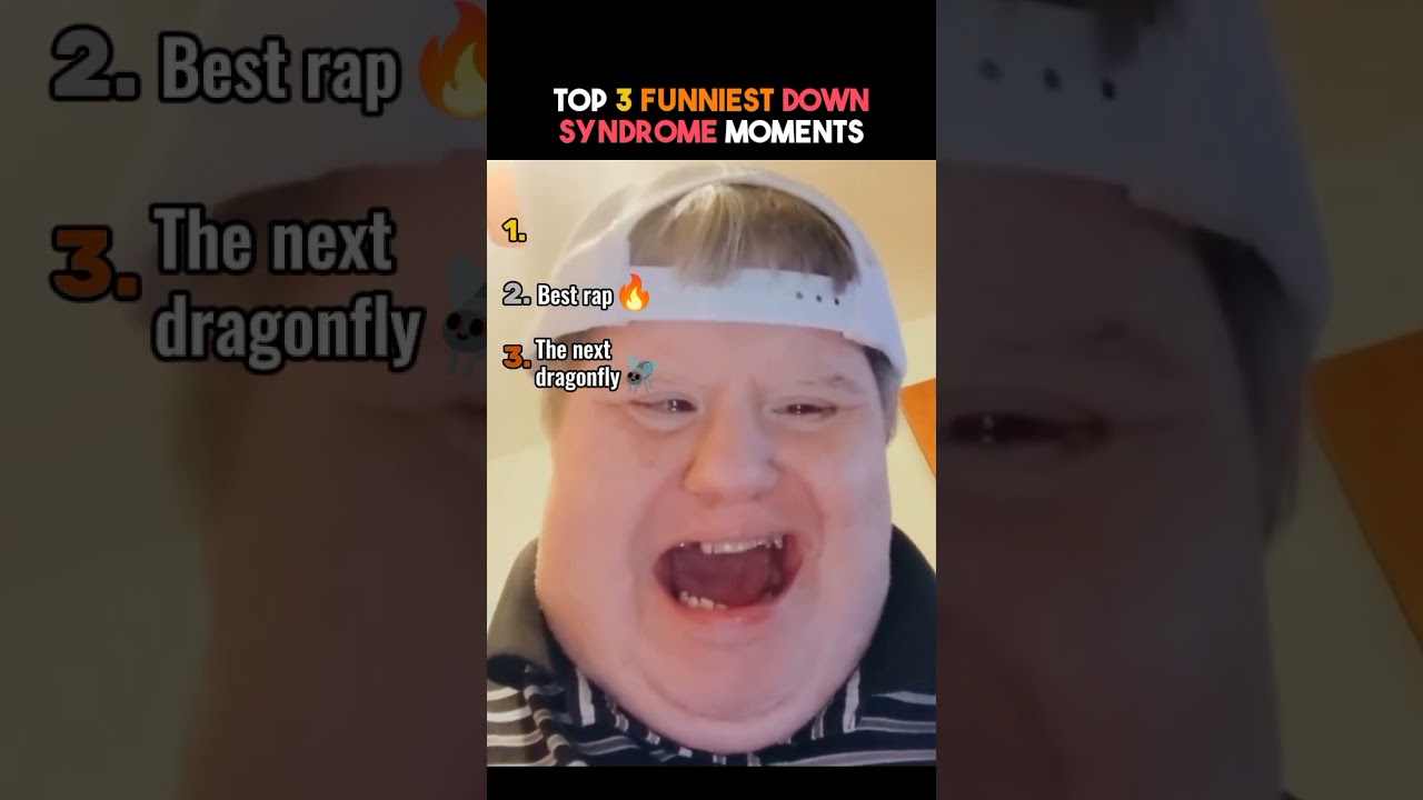 Top 3 Funniest Down Syndrome Moments That Will Brighten Your Day