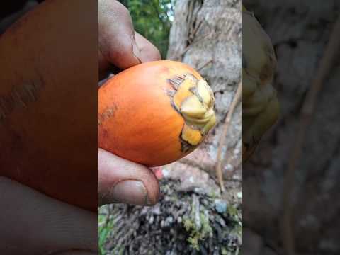 Betel nut cutting gone wrong: A scary injury story