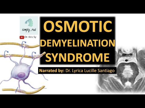 Osmotic demyelination, pontine & extrapontine myelinolysis - simplified