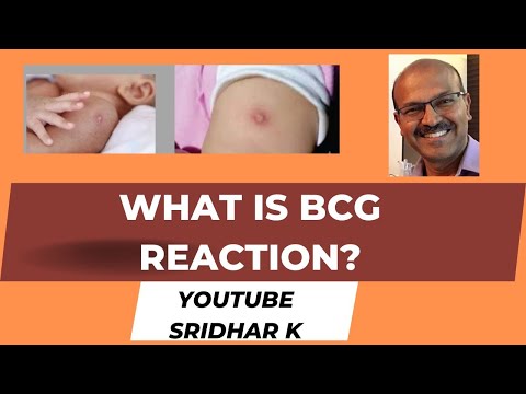 What is BCG reaction? What can parents expect at site of the BCG vaccine? #bcg #BCGvaccinereaction