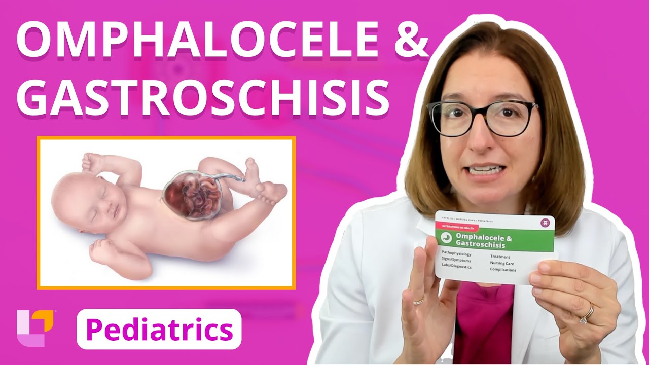 Omphalocele & Gastroschisis -  Pediatric Nursing | @LevelUpRN