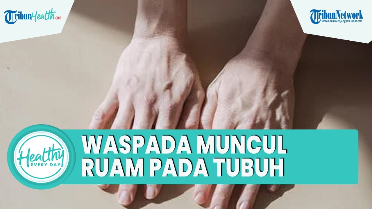 Waspadai Munculnya Ruam Tubuh hingga Pembengkakan Kelenjar Getah Bening ...