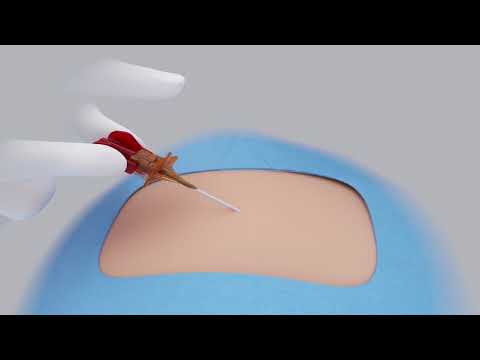 The Cutneedle device by VB devices