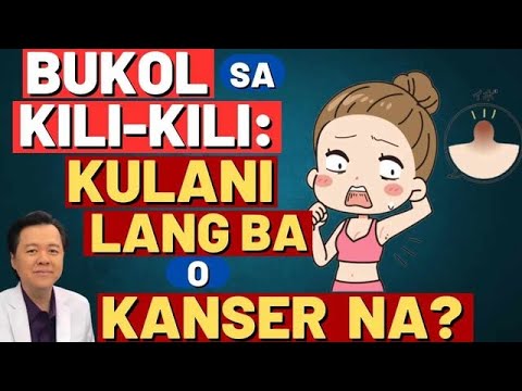 Bukol sa Kili-Kili: Kulani lang ba or Kan-ser Na? - By Doc Willie Ong (Internist and Cardiologist)