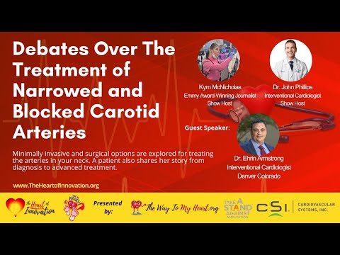 Debates Over The Treatment of Narrowed and Blocked Carotid Arteries