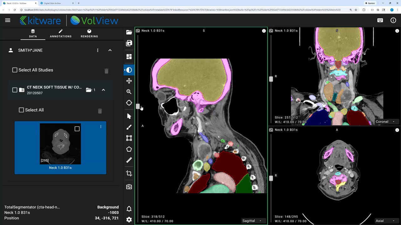 Grider VolView Session Builder Demo