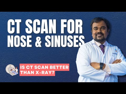 CT scan Nose Sinuses | Sinusitis | Dr. G V K Chaitanya Rao