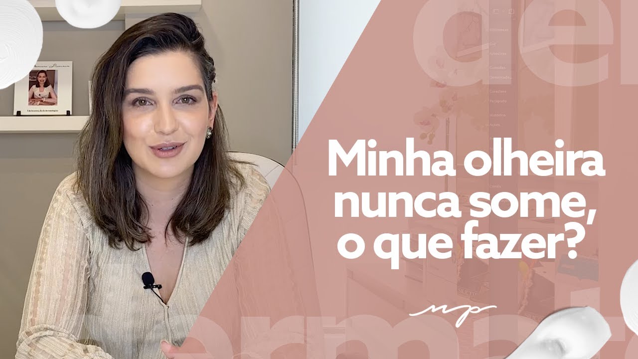 Types of dark circles under the eyes and their treatments.