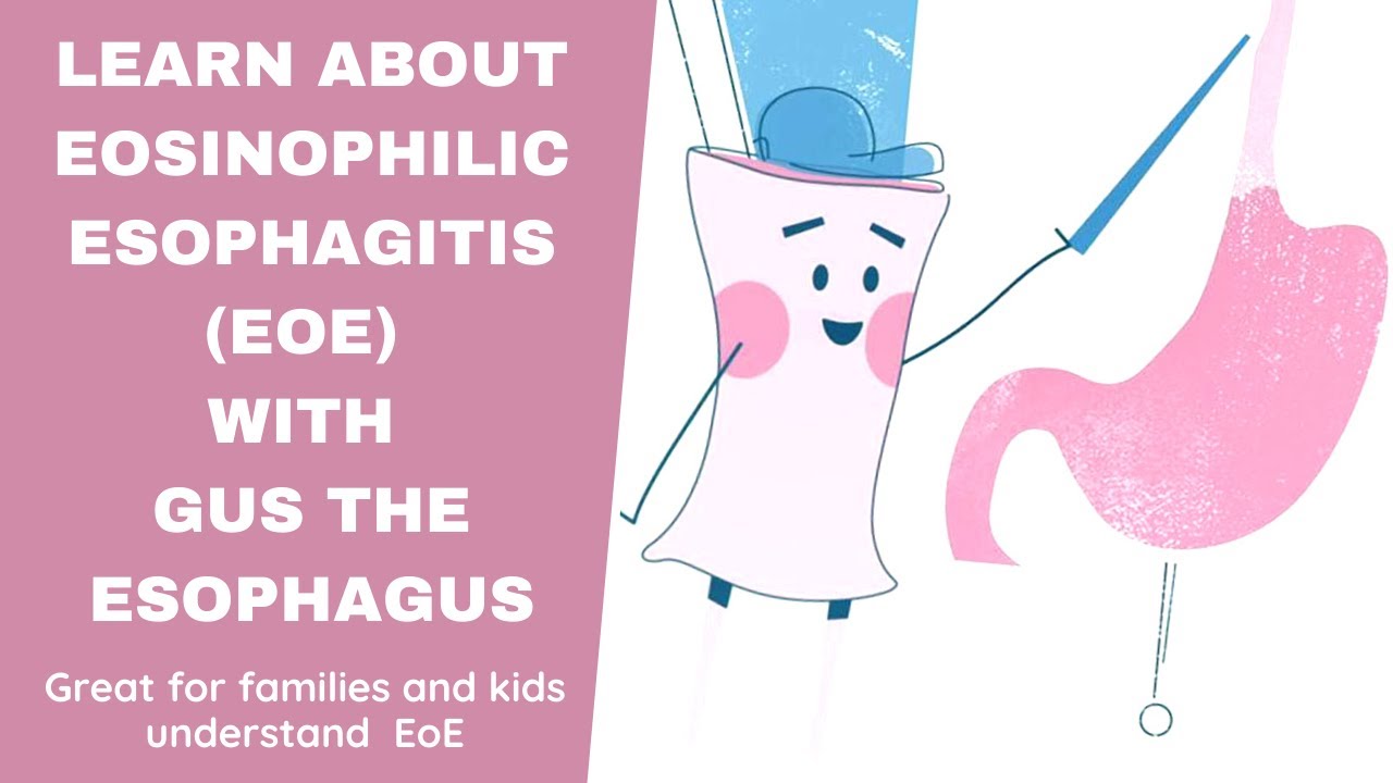 Learn about Eosinophilic Esophagitis (EoE) with Gus the Esophagus