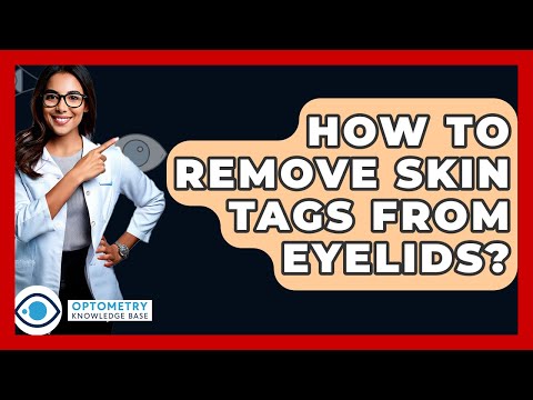 How To Remove Skin Tags From Eyelids? - Optometry Knowledge Base