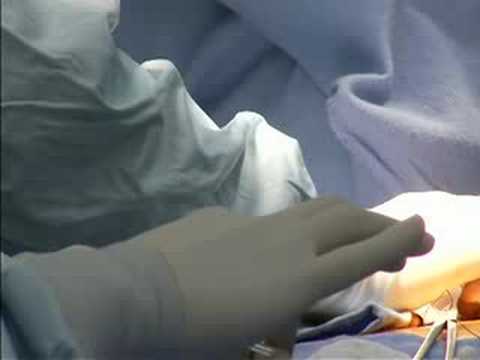 Adult Heart Defects - Mayo Clinic