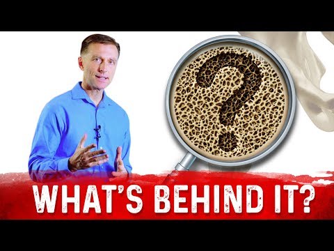 Postmenopausal Osteoporosis – Osteoclast and Osteoblast – Dr.Berg