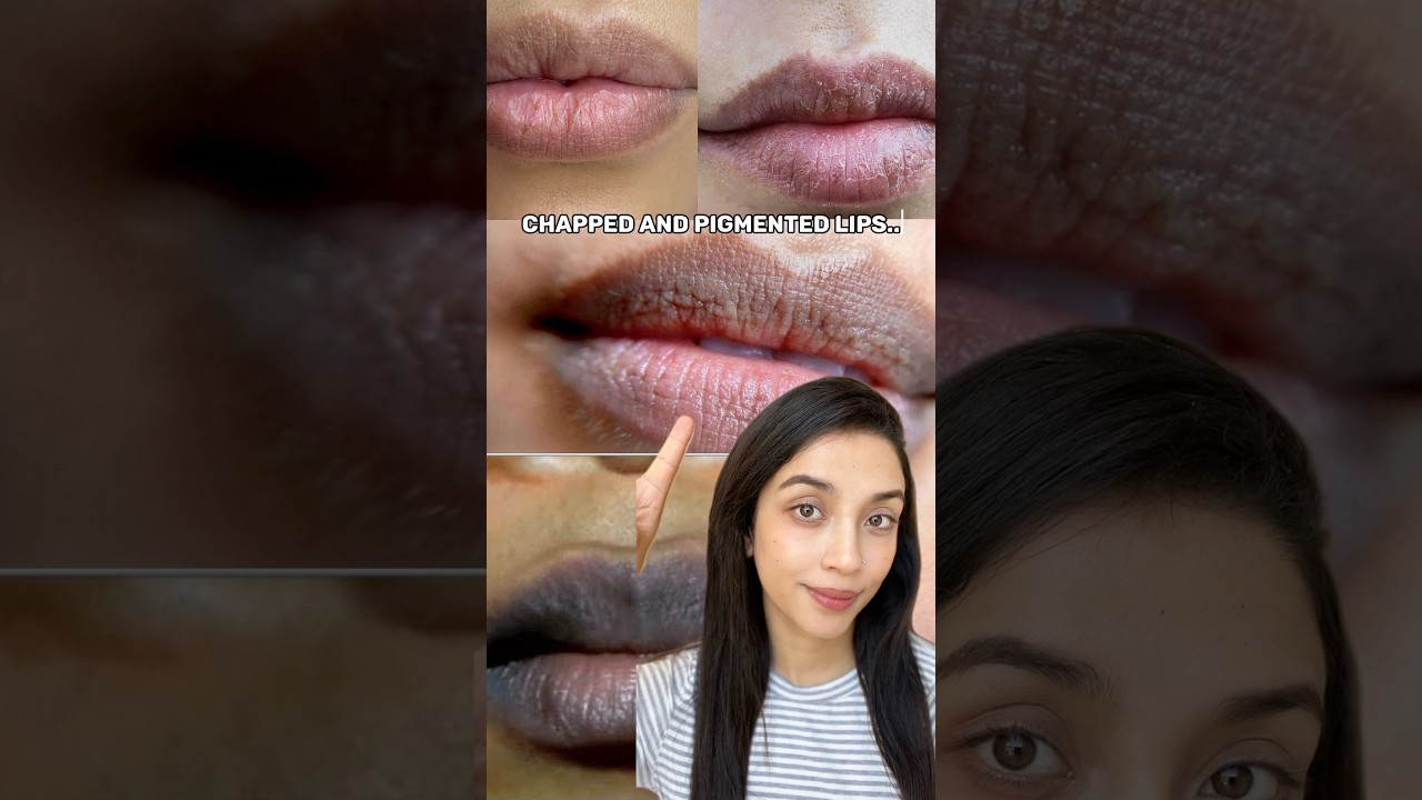 I Tried the Best Lip Balm for pigmented and dry Lips #shorts  #lipbalm  #darklips