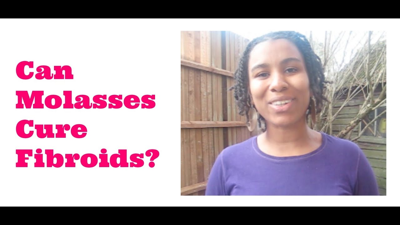Can Molasses Cure Fibroids?