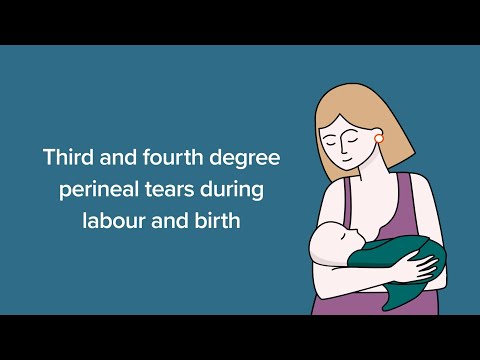 Third and fourth degree perineal tears: A video for women